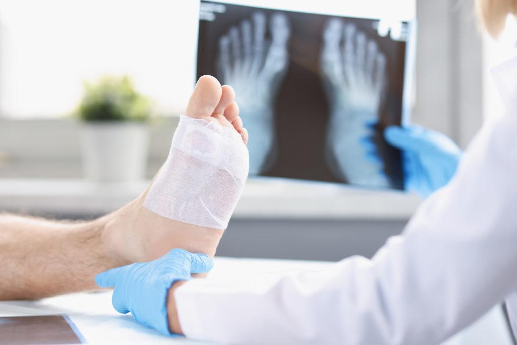 Sports Medicine - Mountain Spring Podiatry