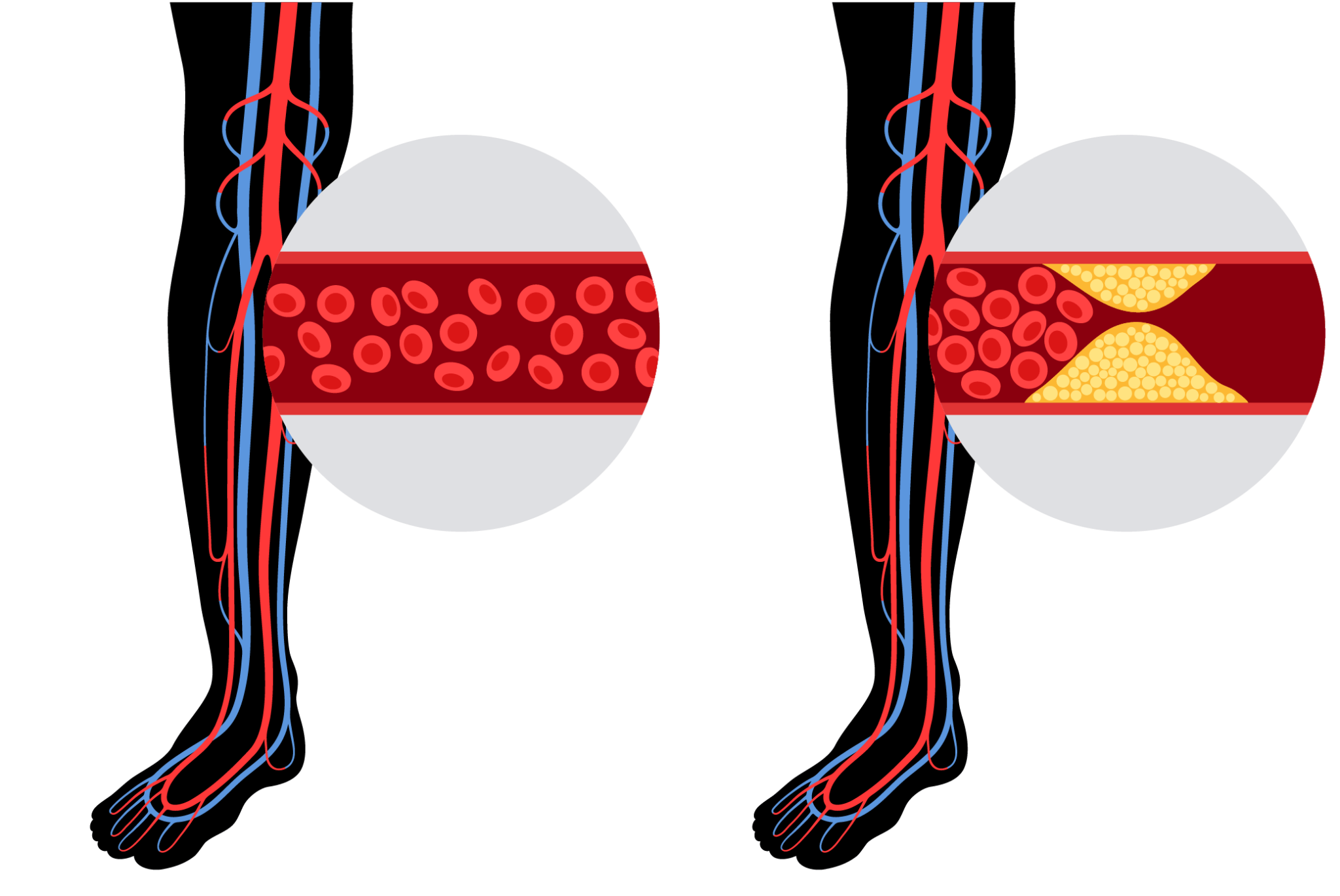 Podiatrist | Foot & Ankle Doctors | Mountain Spring Podiatry